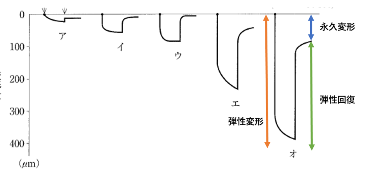 115回歯科医師国家試験【115D-43】 歯科理工学 印象材編 - 歯学部オンライン予備校TIDブログ「歯科材料のツボ」